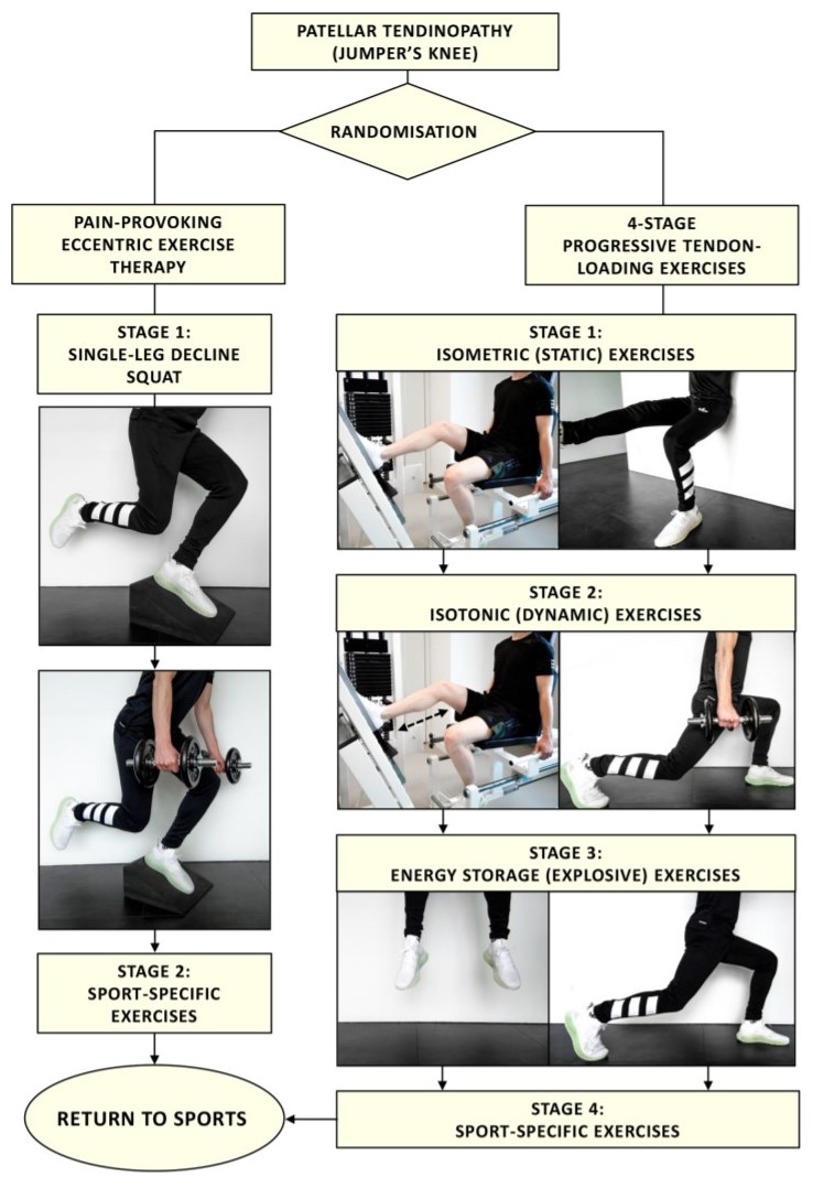 Progressive Tendon Loading Exercises for Patellar Tendinopathy ... Progressive Tendon Loading Exercises for Patellar Tendinopathy ...